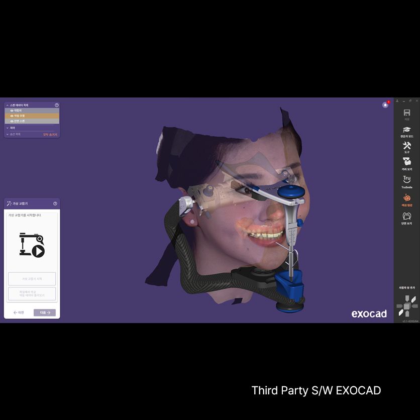 RAY - The Future of Face-Driven Dentistry