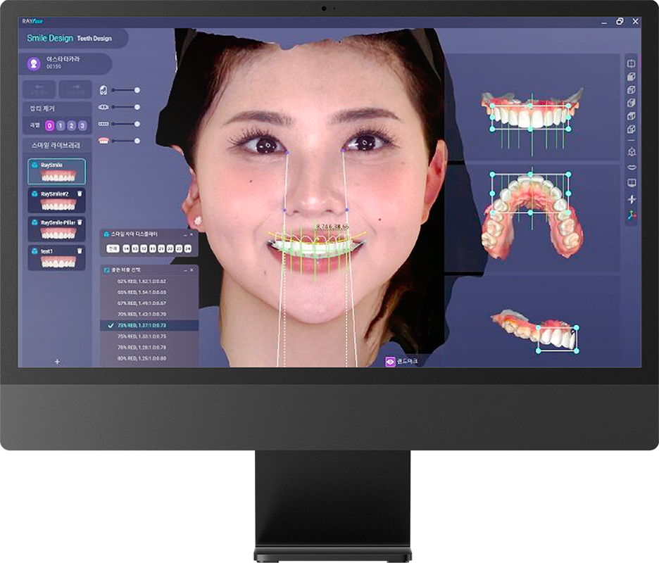 RAY - The Future of Face-Driven Dentistry