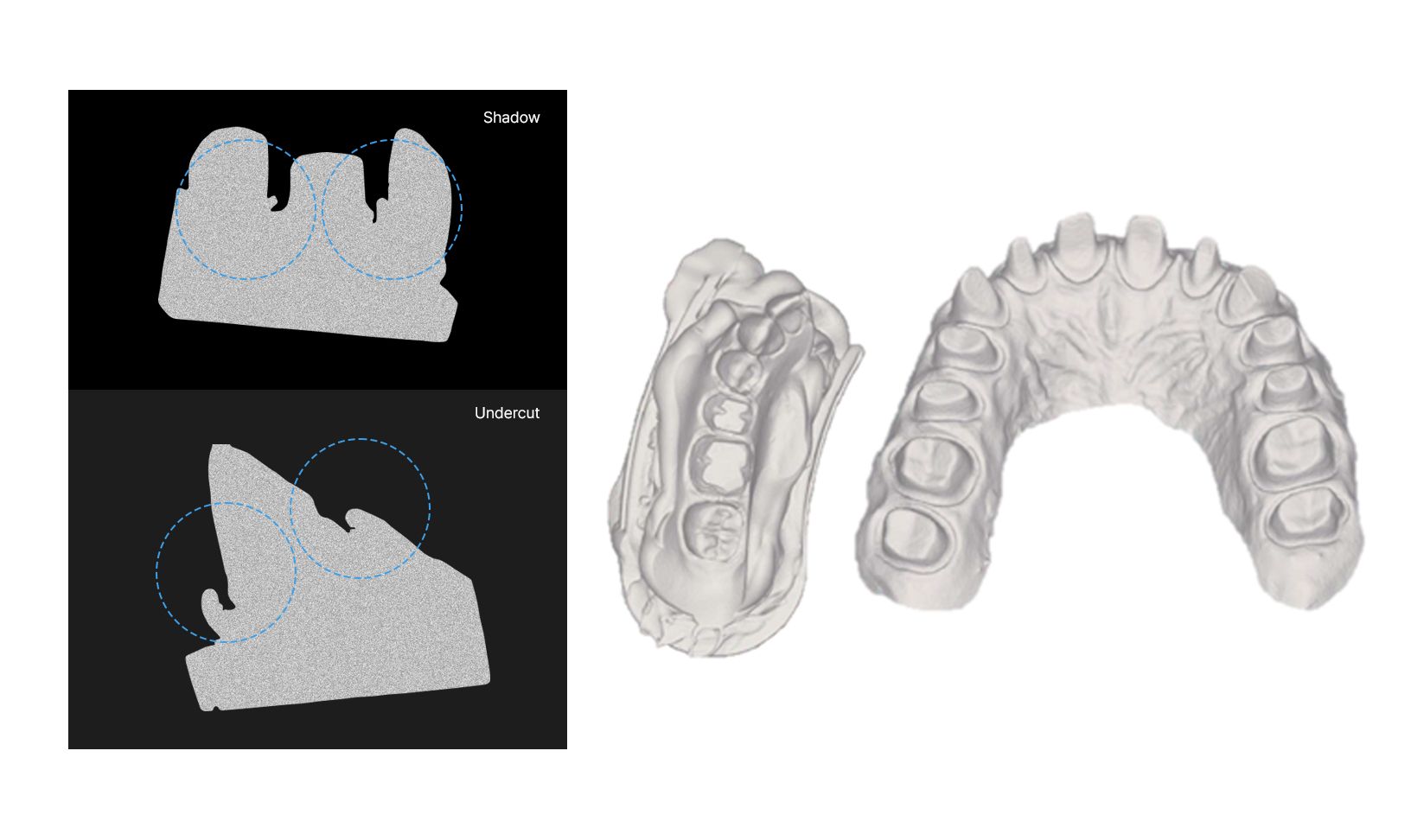 RAY - The Future of Face-Driven Dentistry