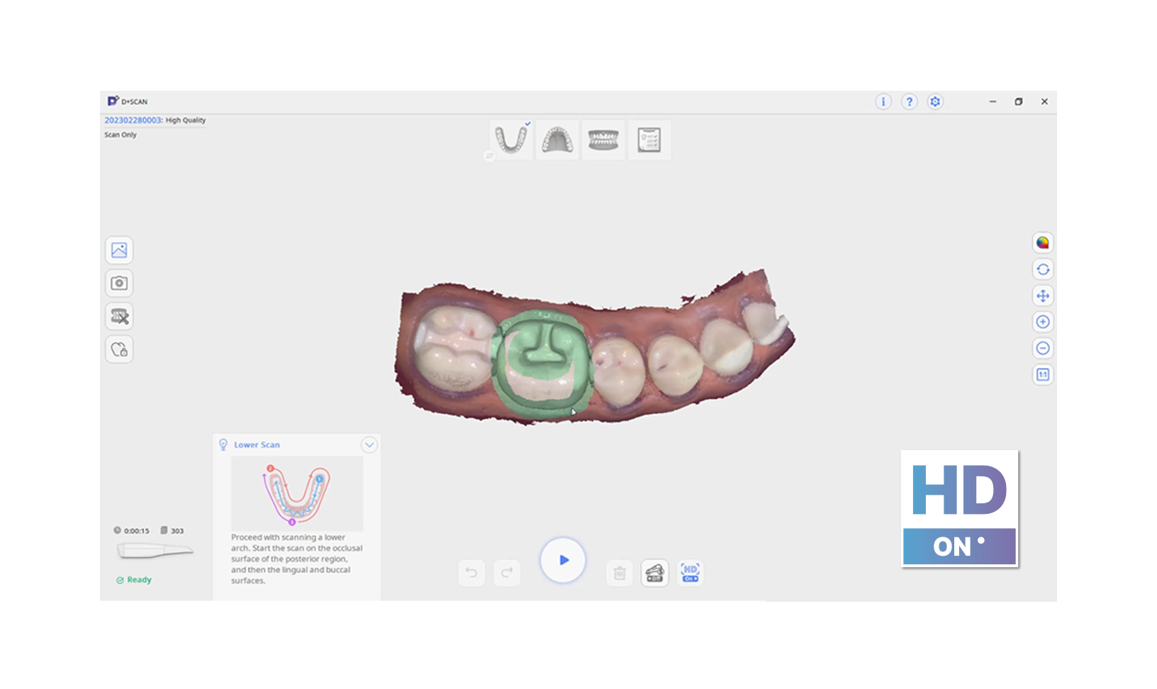 RAY - The Future of Face-Driven Dentistry