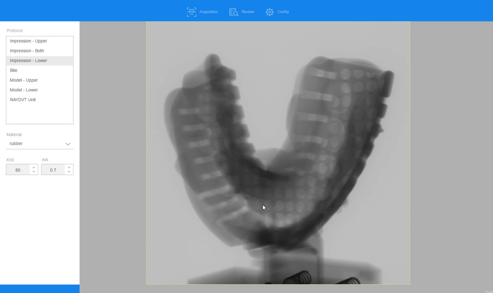 RAY - The Future of Face-Driven Dentistry