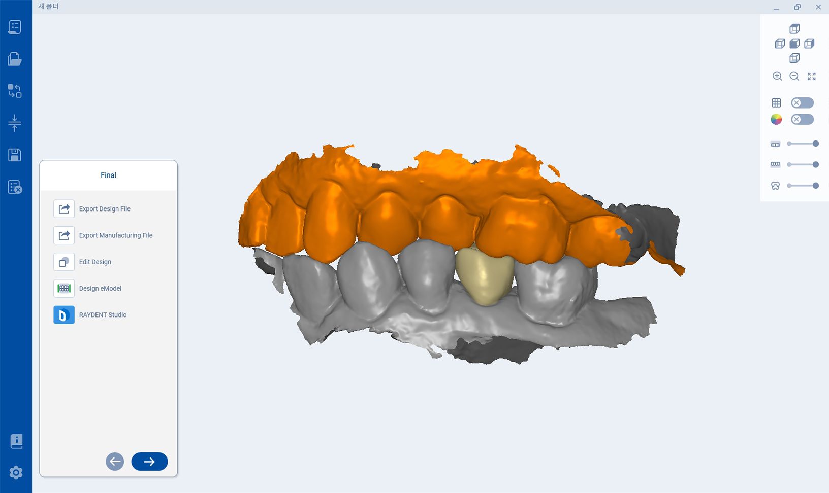 RAY - The Future of Face-Driven Dentistry