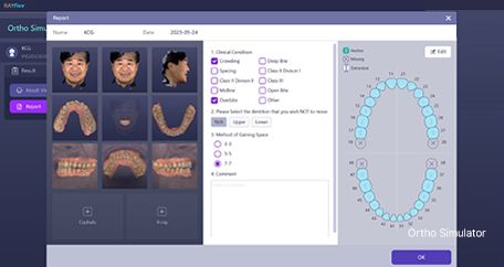 RAY - The Future of Face-Driven Dentistry
