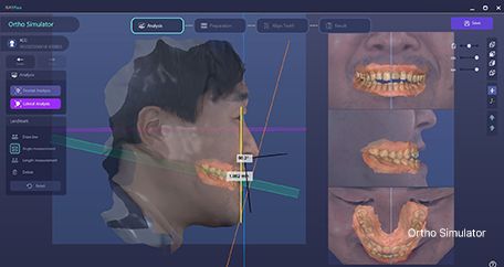 RAY - The Future of Face-Driven Dentistry