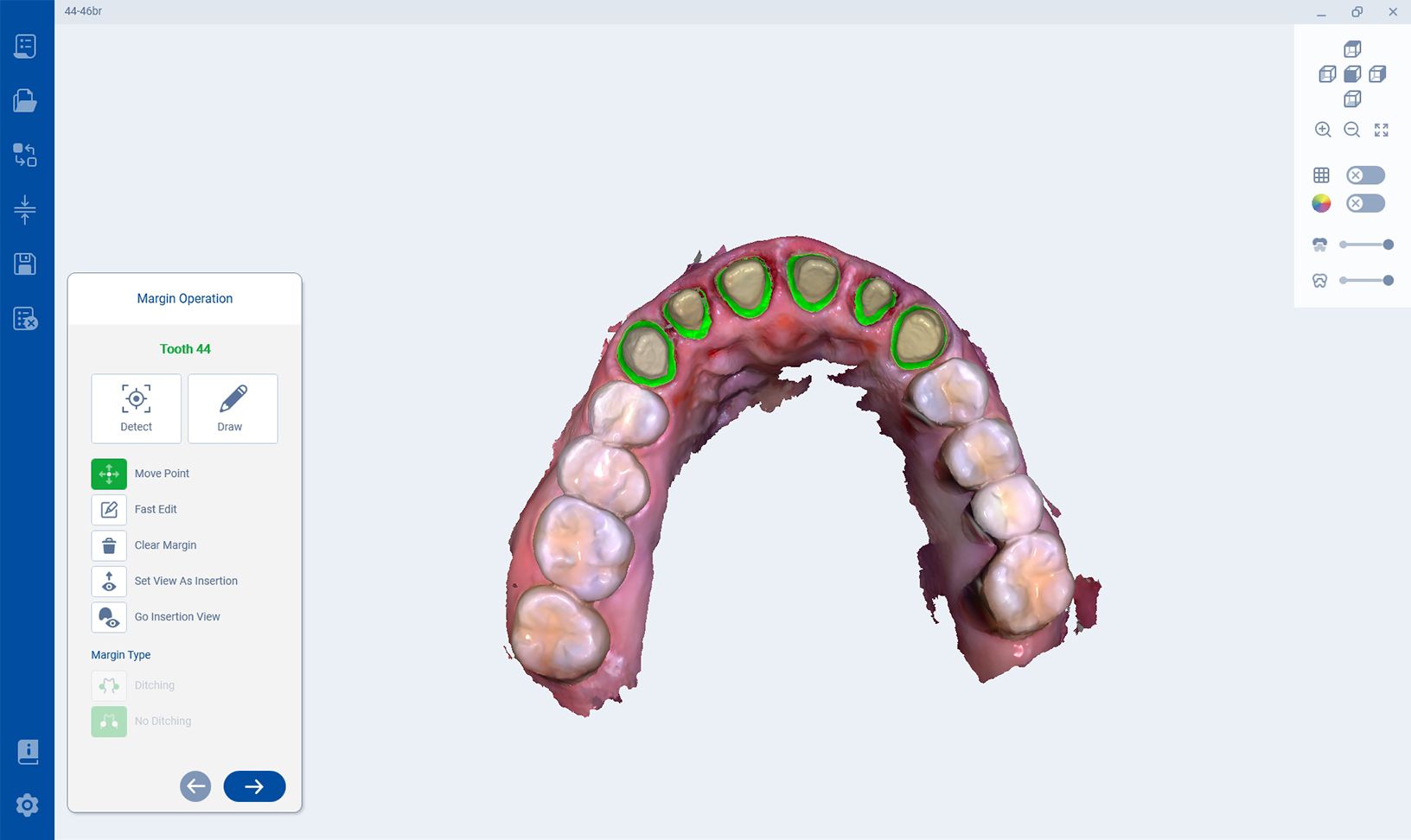 RAY - The Future of Face-Driven Dentistry