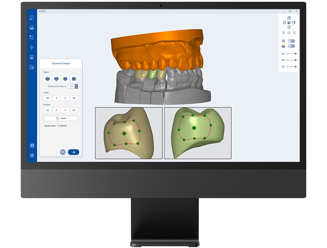 RAY - The Future of Face-Driven Dentistry