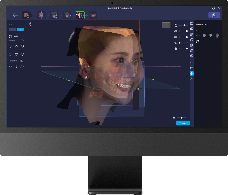 RAY - The Future of Face-Driven Dentistry