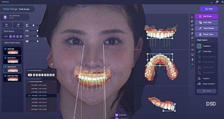 RAY - The Future of Face-Driven Dentistry