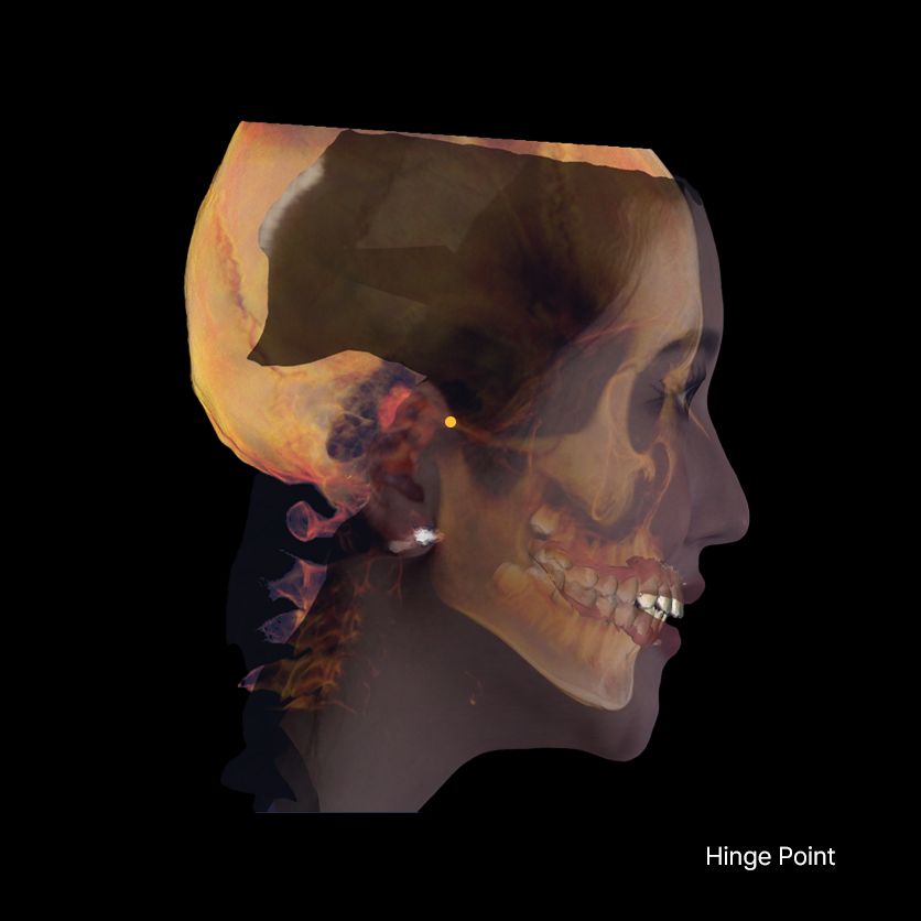 RAY - The Future of Face-Driven Dentistry